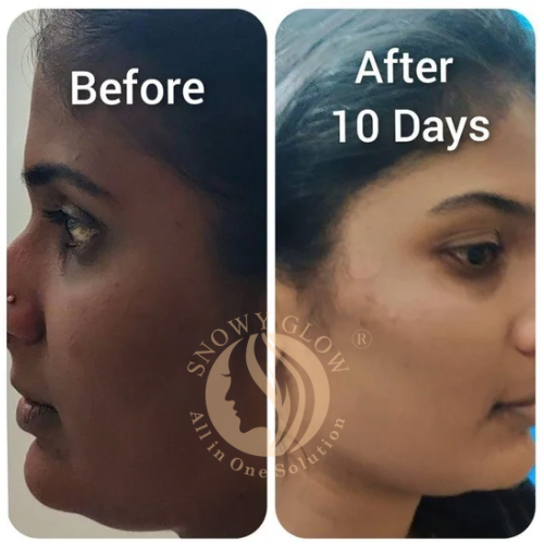 Night Repair Brightening Cream – Snowy Glow